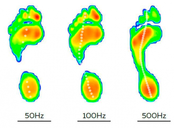Study of the Footprint in Gijón